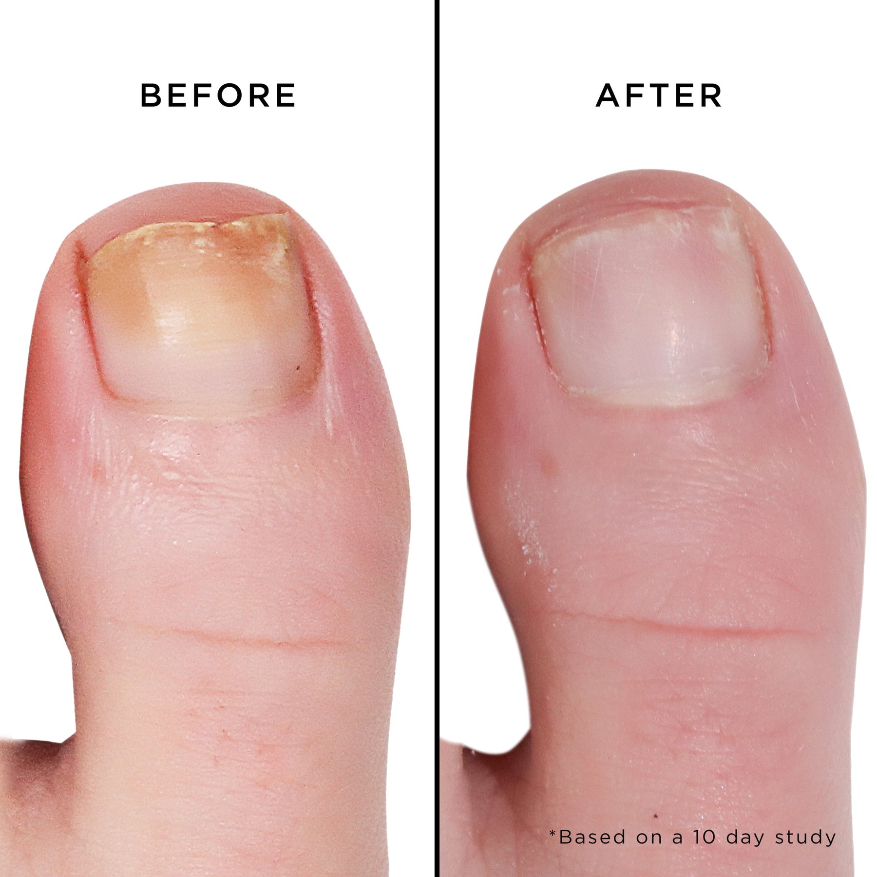 Nail Brightening Kit - Pro 3-Piece for Lustrous Nails